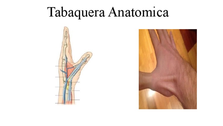 Tabaquera Anatomica | PDF