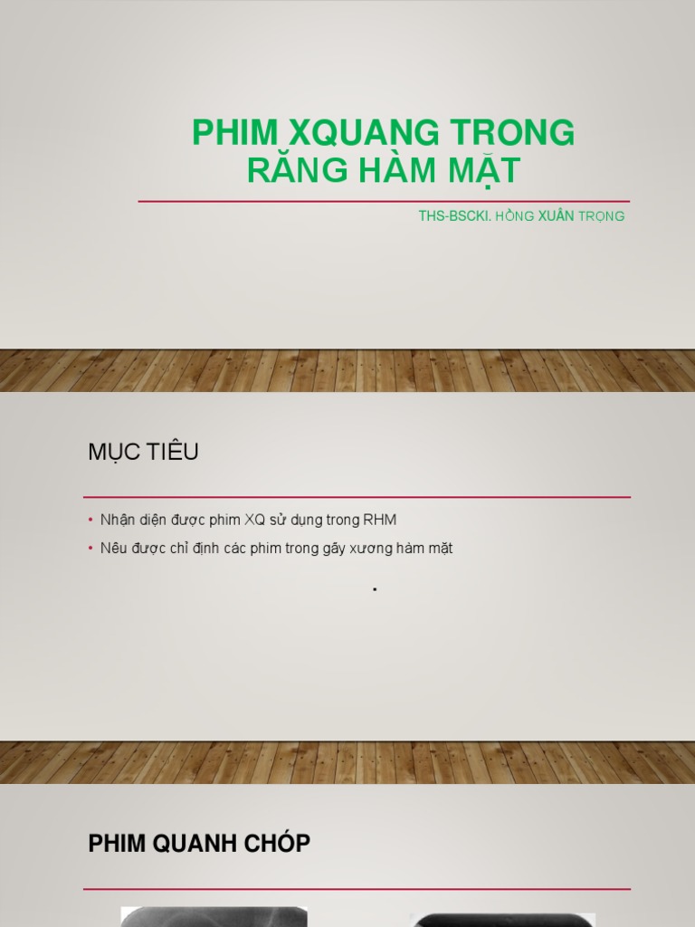 Phim XQ Trong RHM | PDF