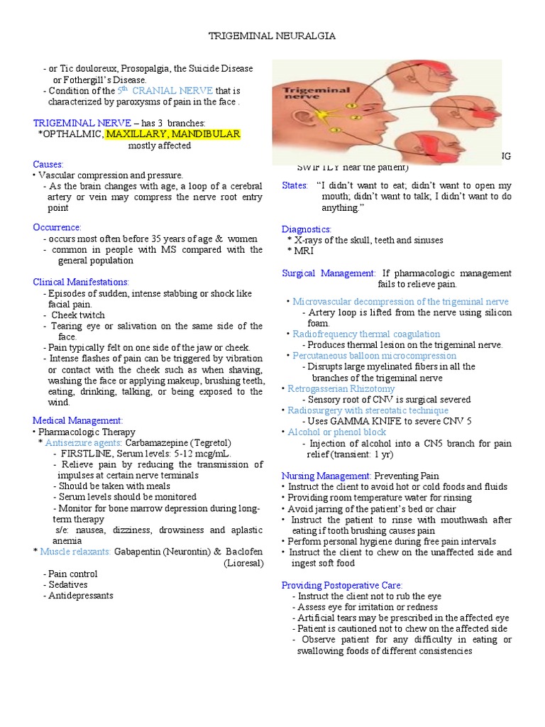 Trigeminal Neuralgia Pdf Neurological Disorders Neurology
