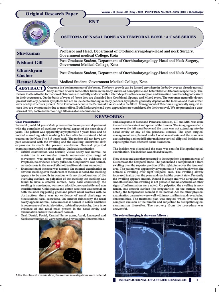 Osteoma of Nasal Bone and Temporal Bone A Case Series - May - 2022 ...