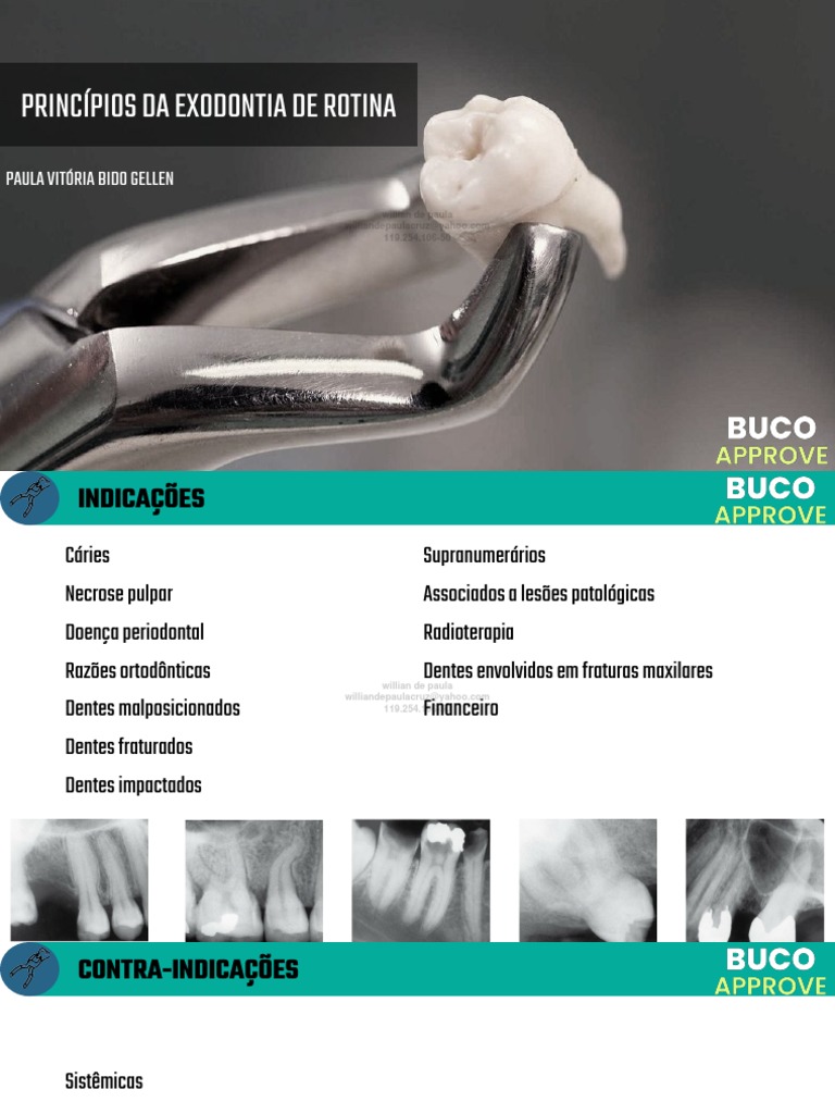 BUCO APPROVE - Princípios de Exodontia de Rotina Parte 2 | PDF | Dente ...