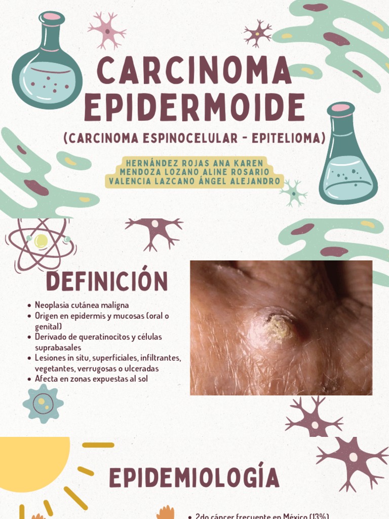 Carcinoma Epidermoide | PDF | Cáncer | Piel