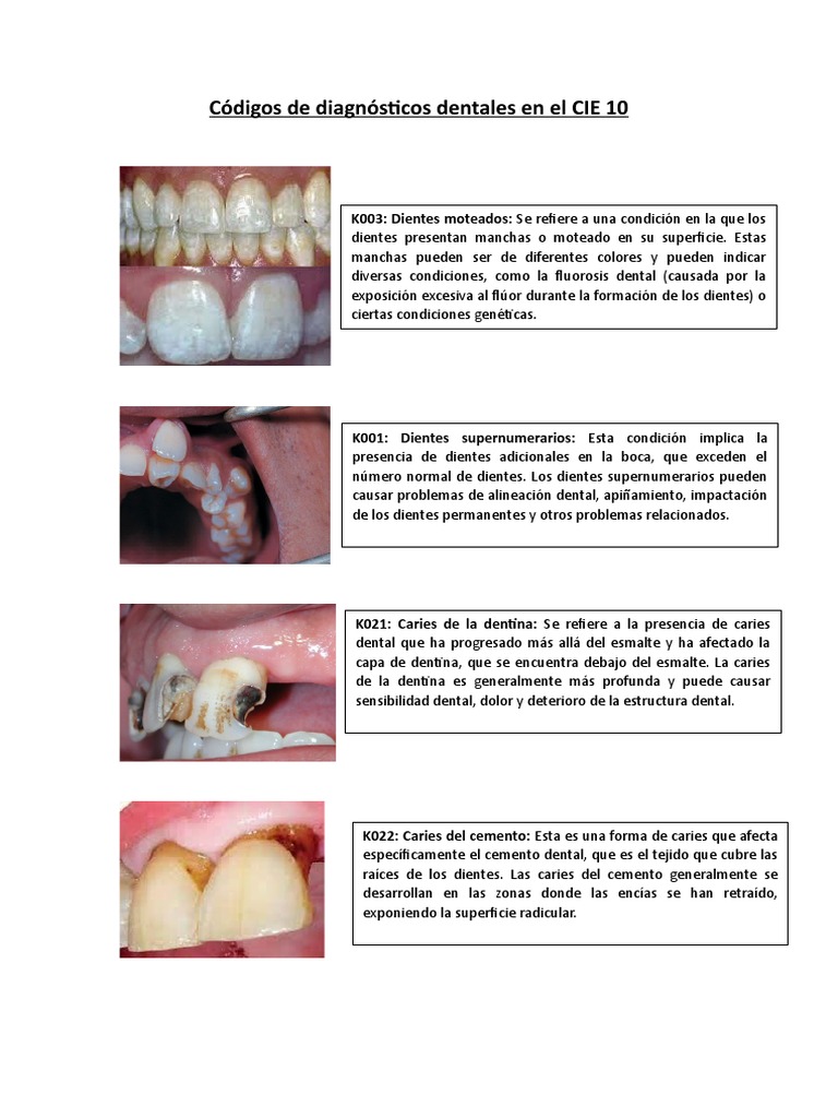 Códigos de Diagnósticos y Tratamientos Yo Procedimientos Dentales en El ...