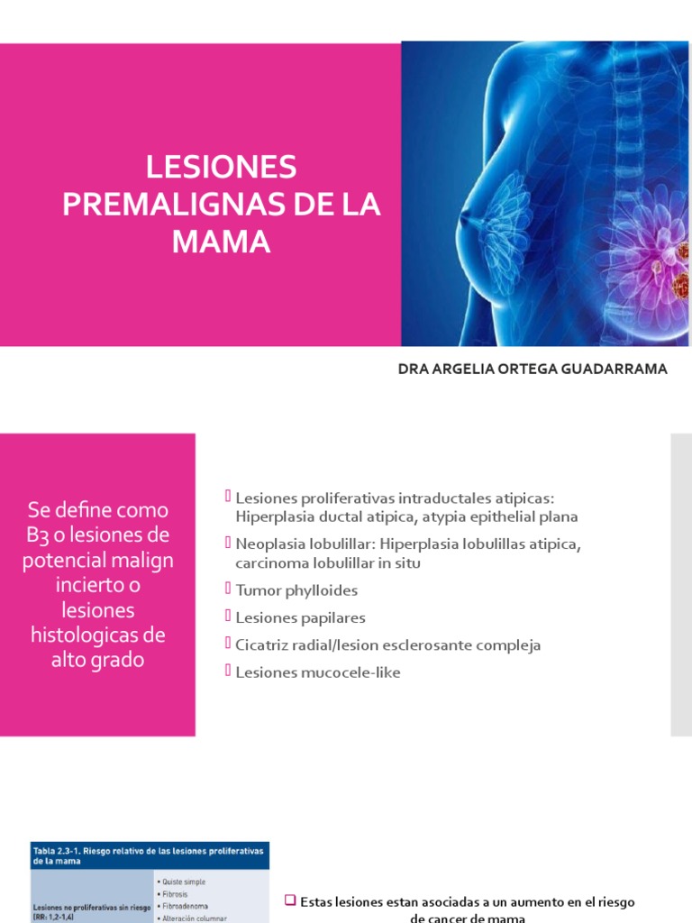 Lesiones Premalignas de La Mama | PDF