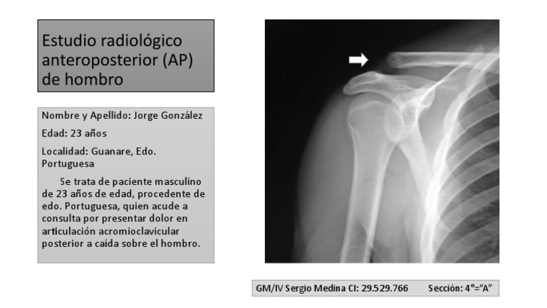 Estudio Radiológico Anteroposterior (AP) de Hombro | PDF