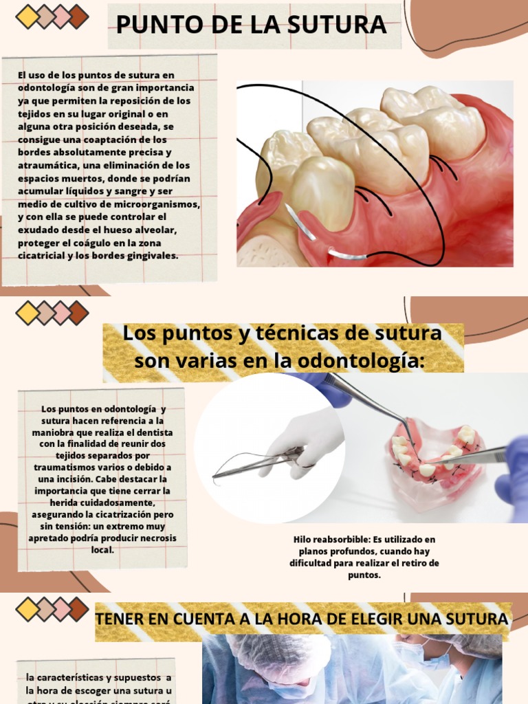 Clasificación de Las Técnicas de Sutura | PDF | Odontología | Sutura Quirúrgica