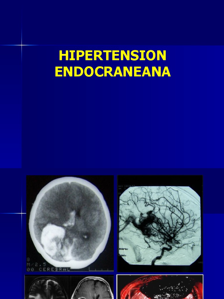 Hipertension Intracraneal 2016 | PDF | Medicina CLINICA ...
