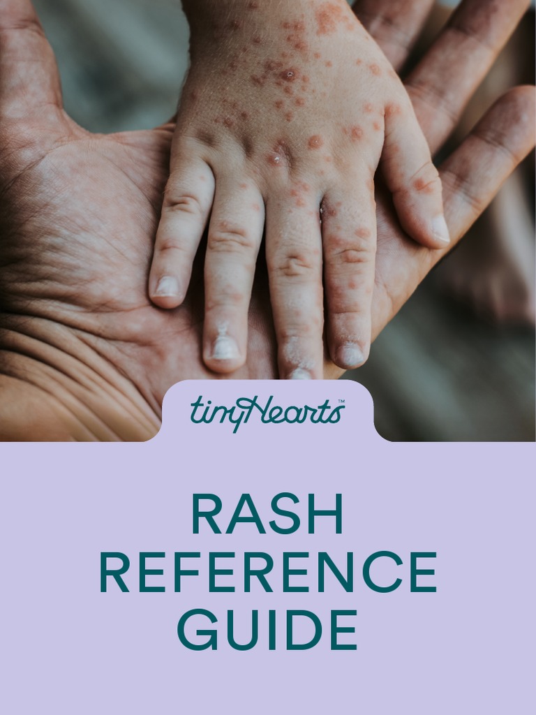 Rash Reference Guide WEB 1 | PDF