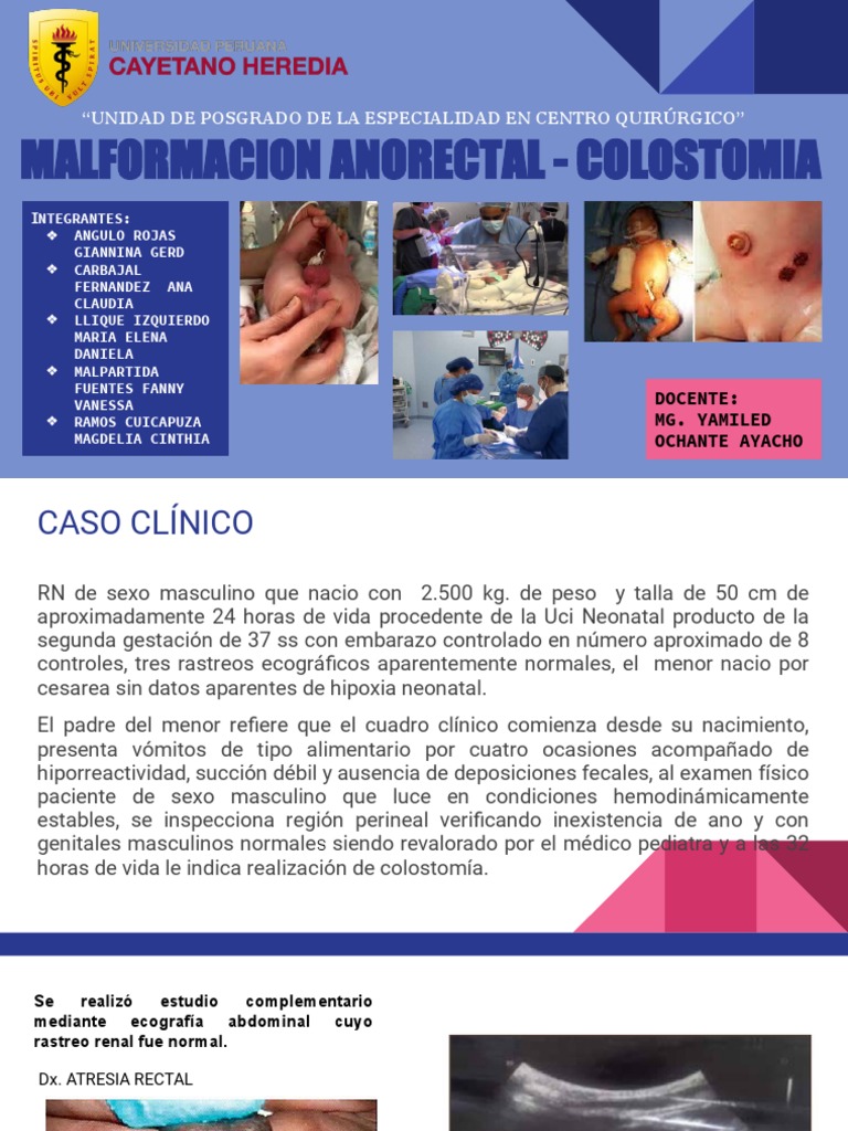 Colostomía en Malformación Anorrectal Neonatal | PDF