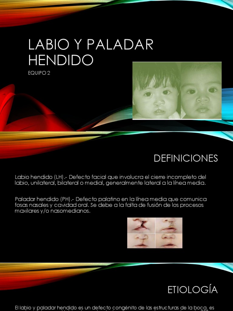 Labio y Paladar Hendido: Guía Integral | PDF | Medicina | Medicina CLINICA