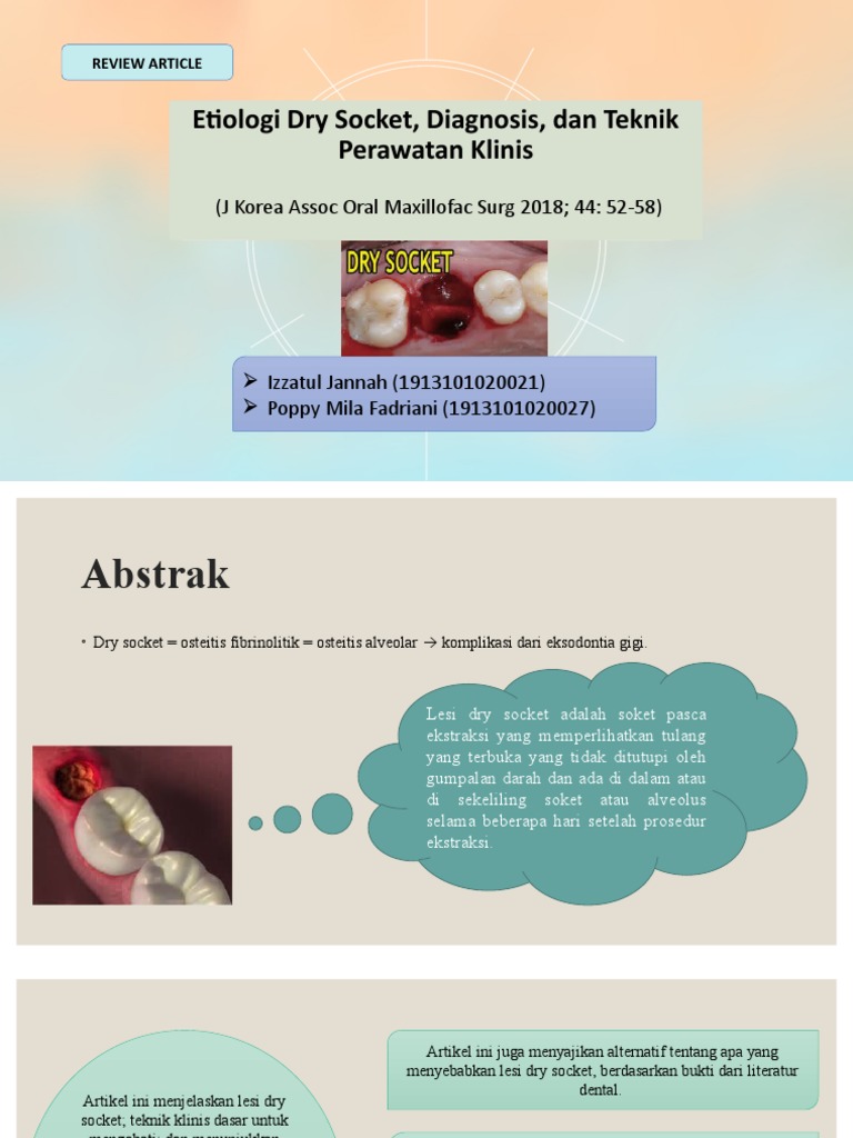 Dry Socket (FIX) | PDF
