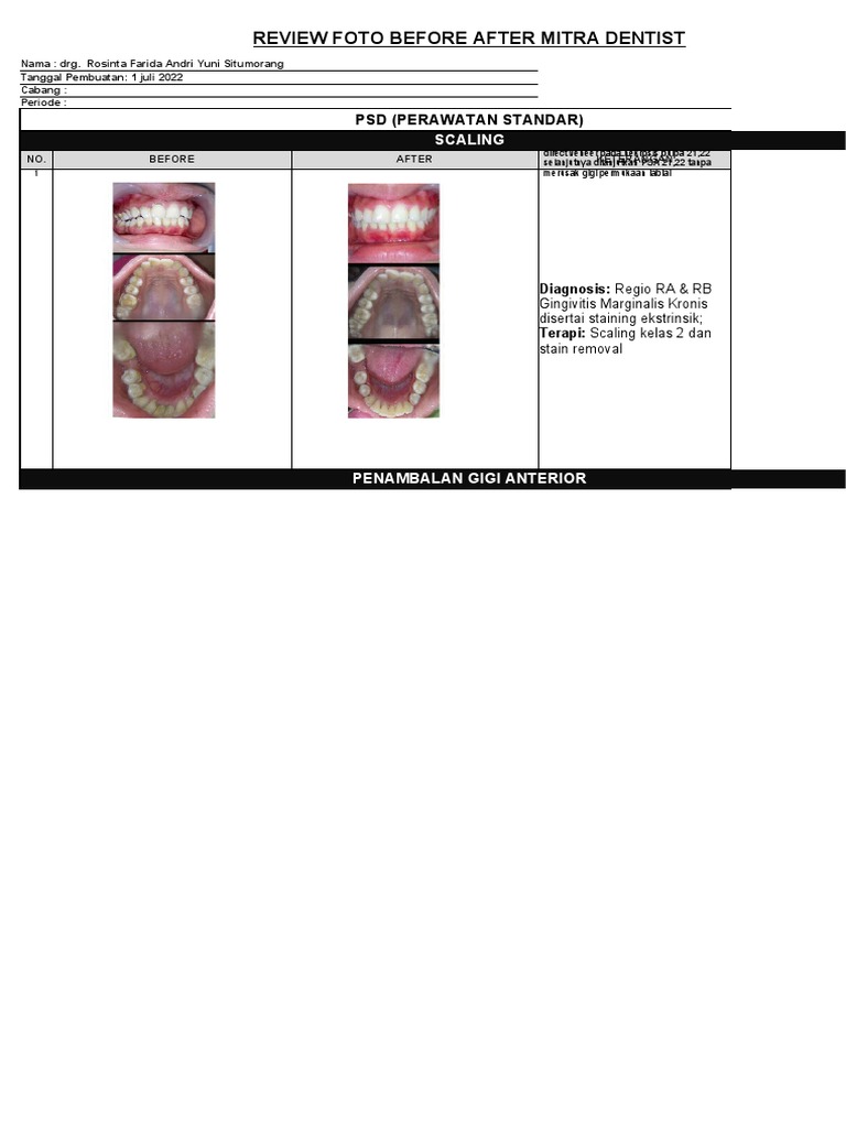 Contoh Foto BA Sesuai Standar OMDC PSD DRG Rosinta | PDF