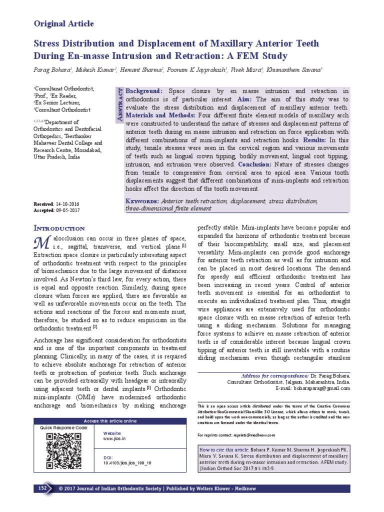 Bohara Et Al 2017 Stress Distribution and Displacement of Maxillary ...