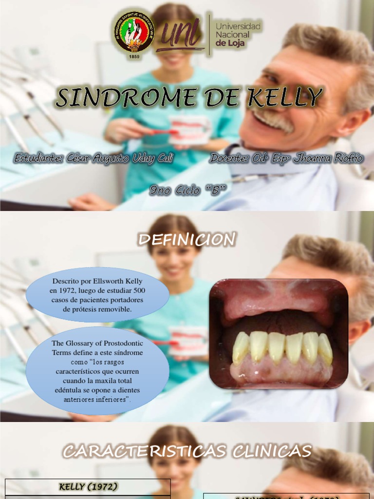 Sindrome de Kelly | PDF