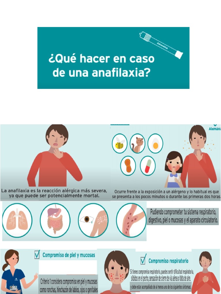 Anafilaxia | PDF