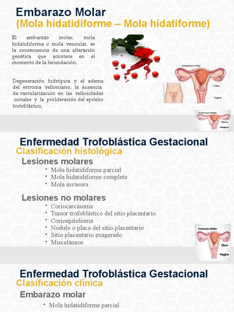 Mola | PDF | El embarazo | Medicina CLINICA
