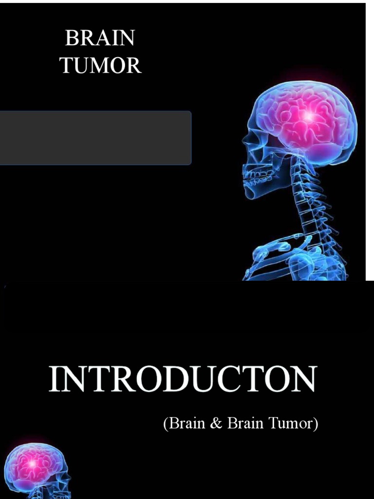 Braintumor 7 Pdf Brain Tumor Radiation Therapy