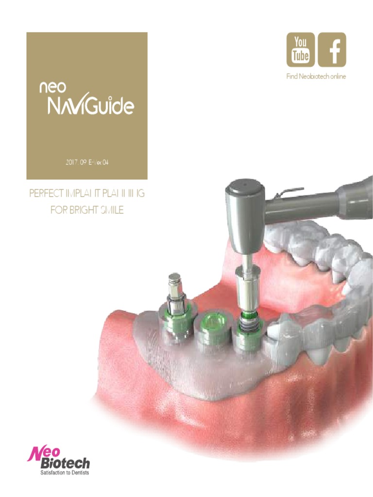62faf8ad9cb0adfcc15acadb - Neo NaviGuide Catalog | PDF | Dental Implant | Surgery