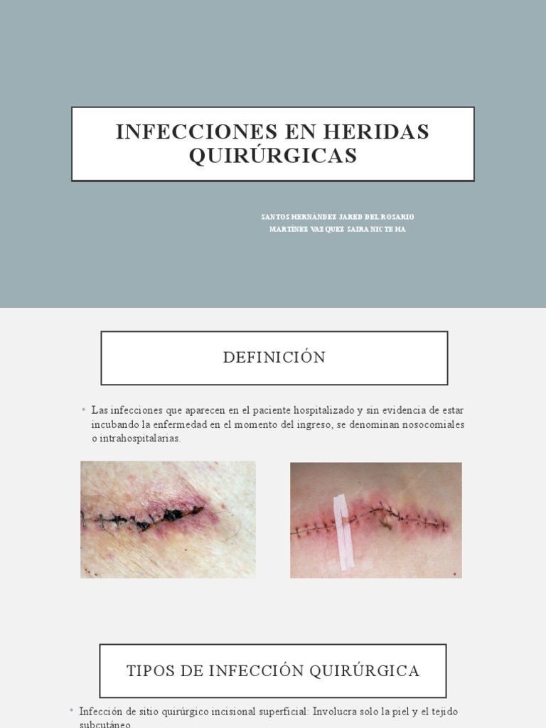 Infecciones en Heridas Quirúrgicas | PDF | Cirugía | Abdomen