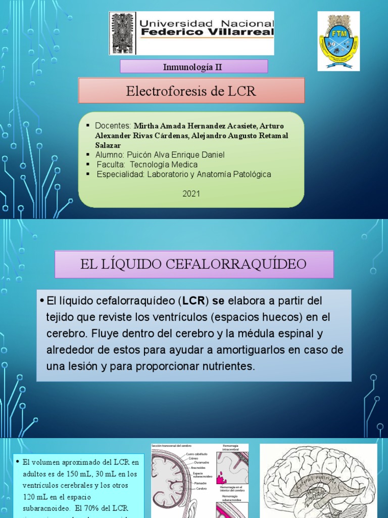 Electroforesis de LCR | PDF | Fluido cerebroespinal | Esclerosis múltiple
