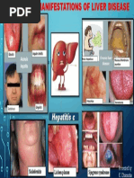 SLE: Etiology, Pathogenesis, Clinical Manifestations, and Management ...