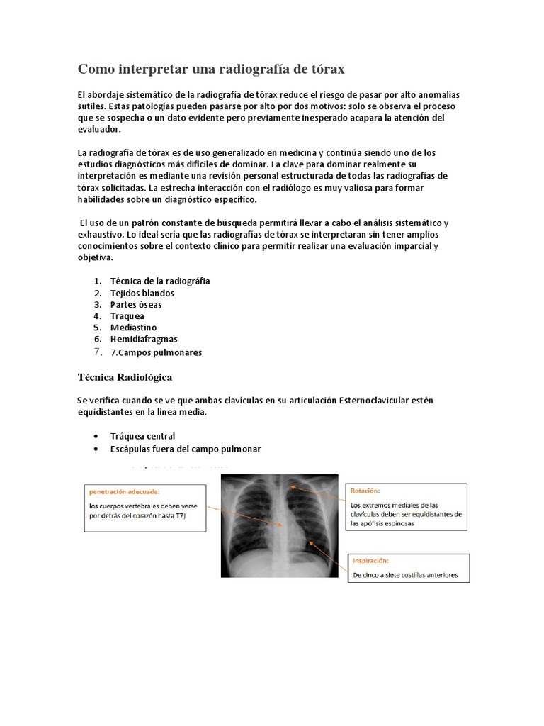 Interpretacion de Una Radiografia de Torax. | PDF | Tórax | Pulmón