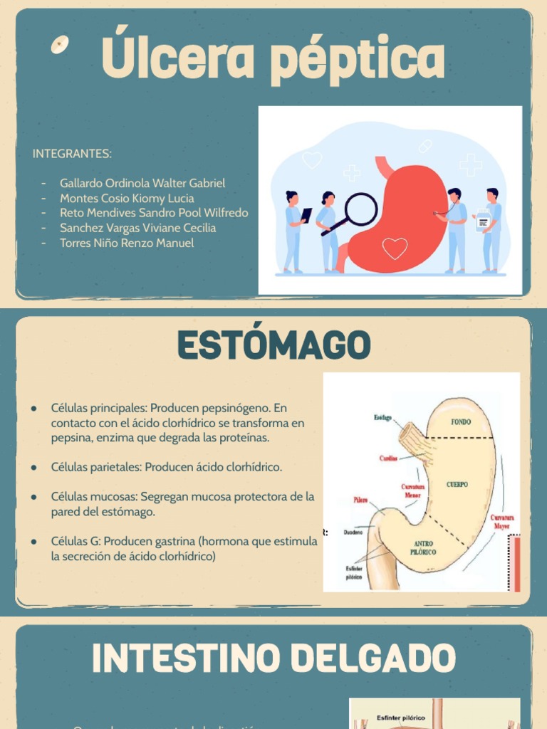 Causas y tratamiento de úlcera péptica | PDF | Estómago | Anatomía