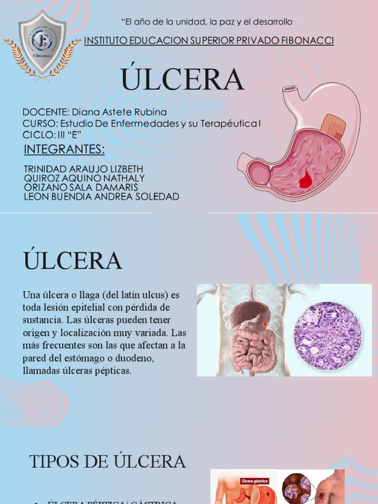 Ulceras | PDF | Herida | Estómago