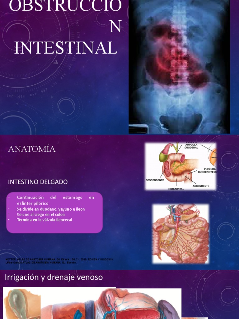 Clasificación y manejo de obstrucción intestinal | PDF | Intestino ...