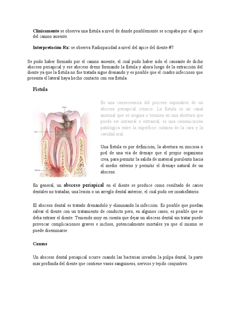 Seminario Proceso Infeccioso Periapical | PDF | Diente | Infección