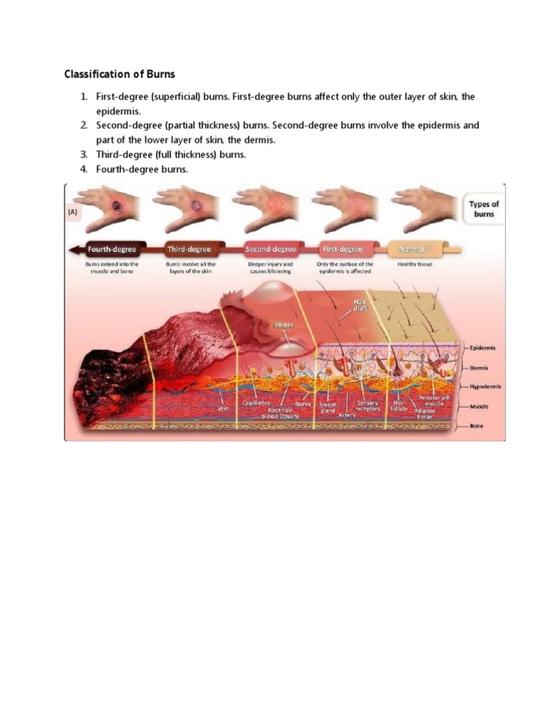 Classification of Burns Explained | PDF