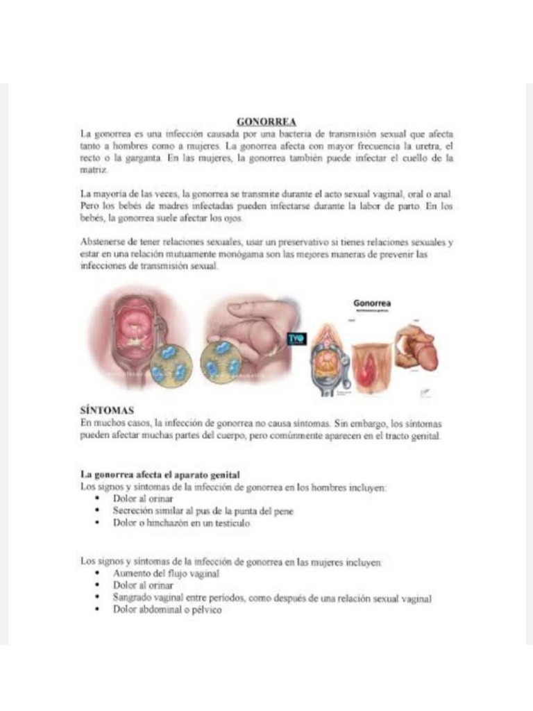 Gonorrea | PDF