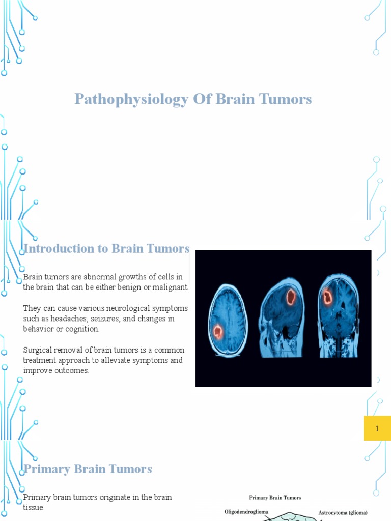 Pathophysiology of Brain Tumors | Download Free PDF | Brain Tumor | Angiogenesis