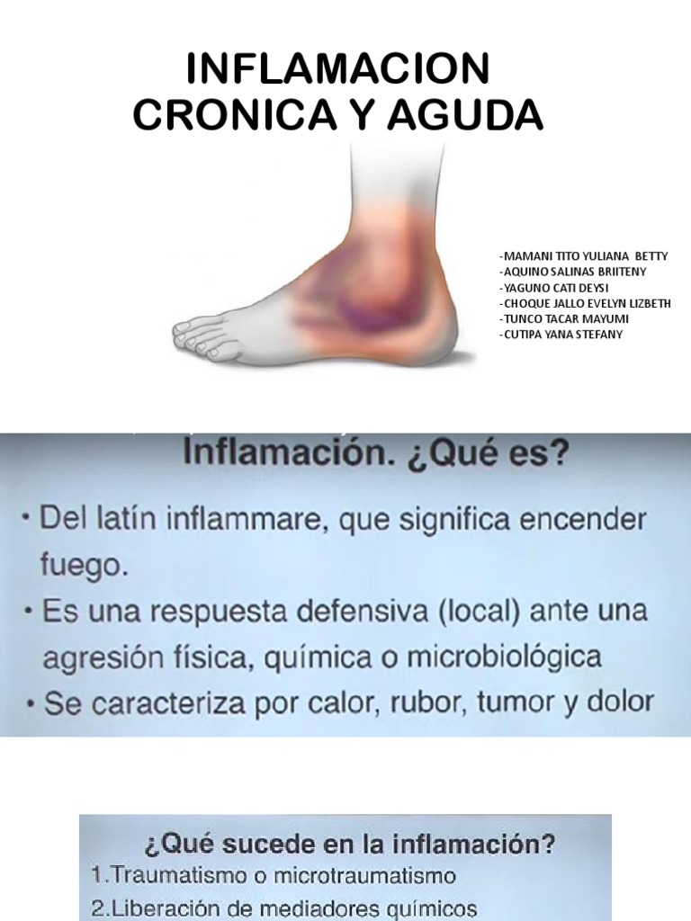 INFLAMACION AGUDA Y CRONICA. 1er Grupo PDF | PDF | Inflamación | Macrófago