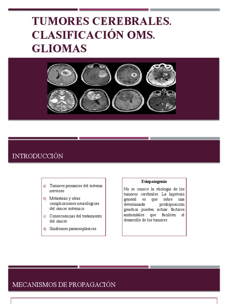 Tumores Cerebrales | PDF | Glioma | Cáncer