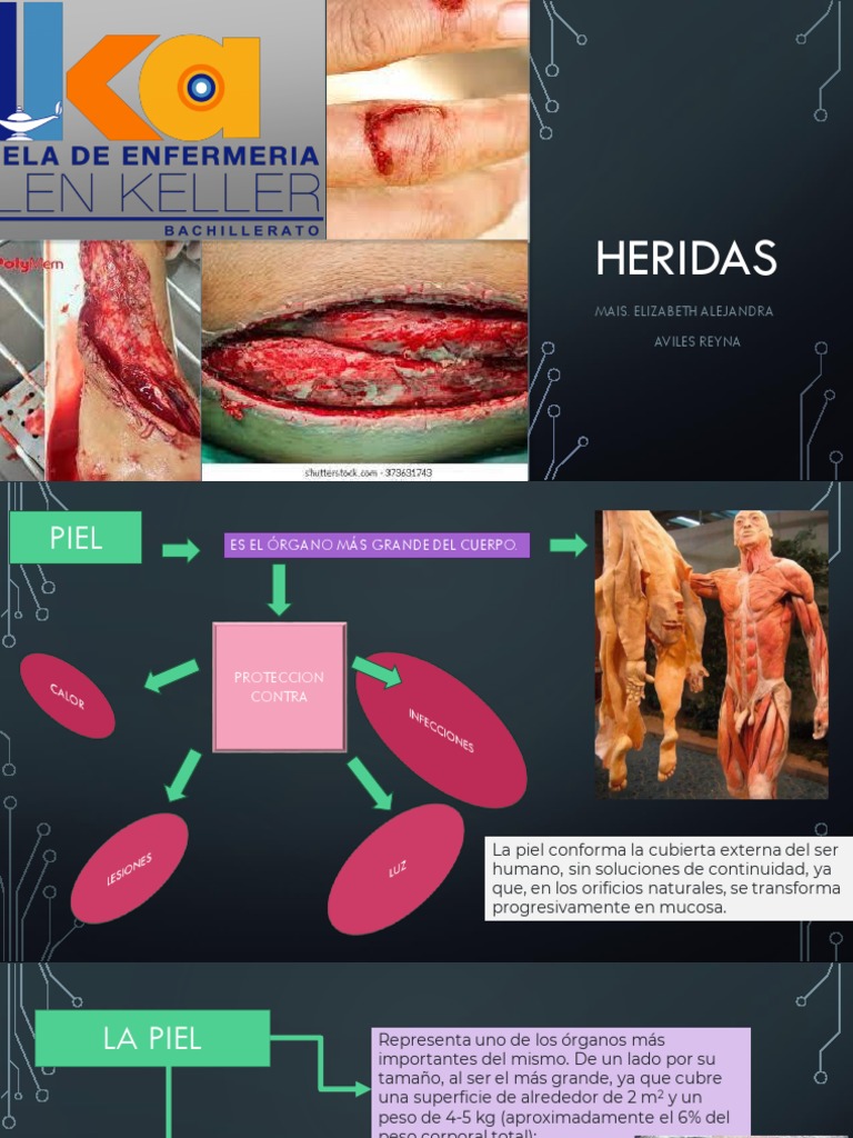 HERIDAS | PDF | Herida | Cicatrización de la herida