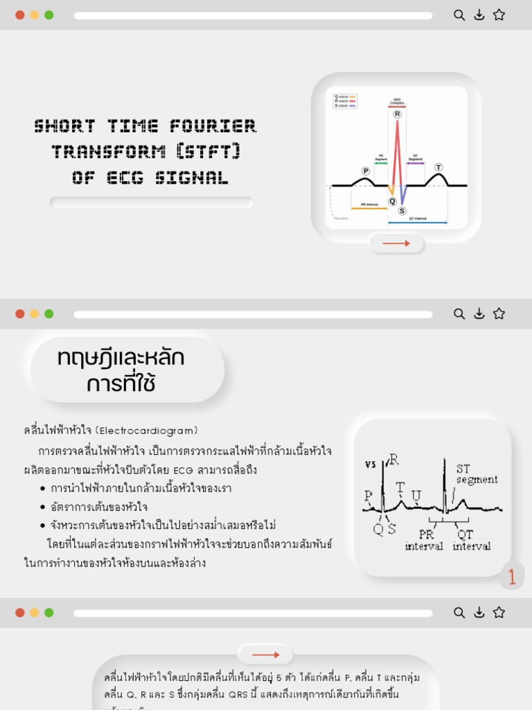 Short Time Fourier Transform (STFT) of ECG Signal | PDF Short Time Fourier Transform (STFT) of ECG Signal | PDF