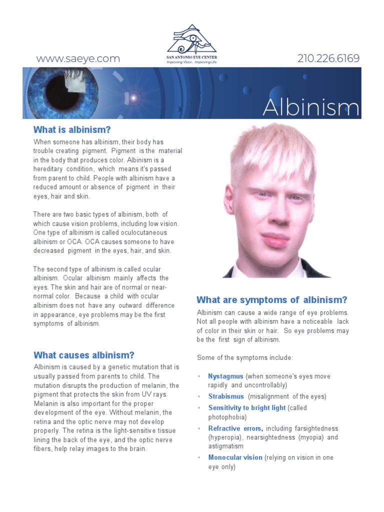 Albinism | PDF | Human Eye | Eye