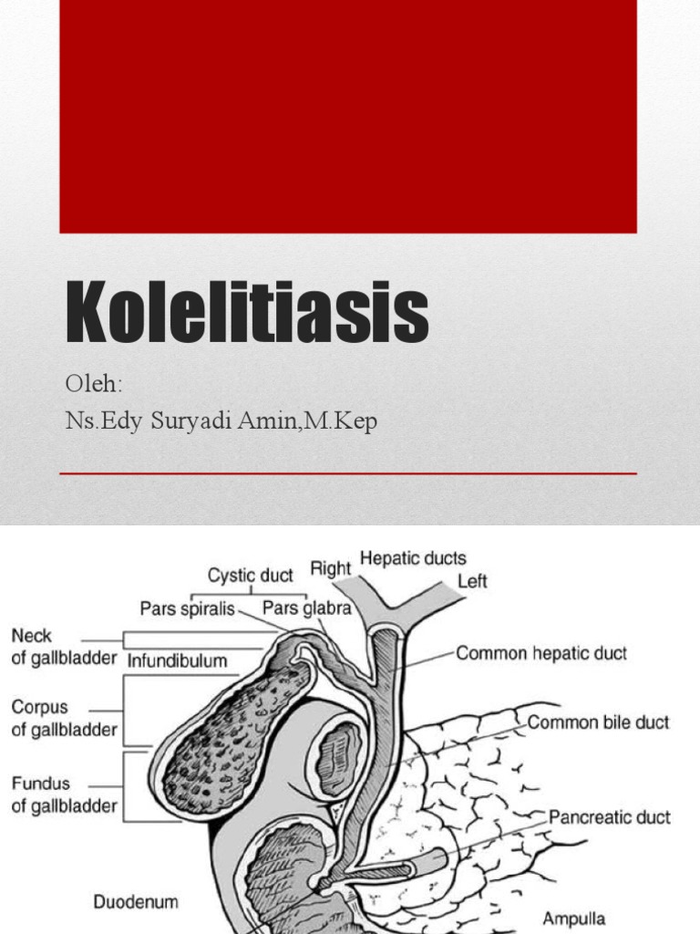 Kolelitiasis | PDF