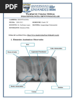 Diaz Apaza Anthony Jesus-Diascopia - Vitropresion | PDF ...
