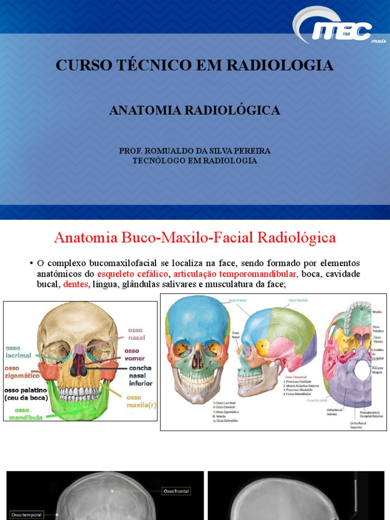 AULAS DE ANATOMIA RADIOLÓGICA | PDF | Cotovelo | Dente