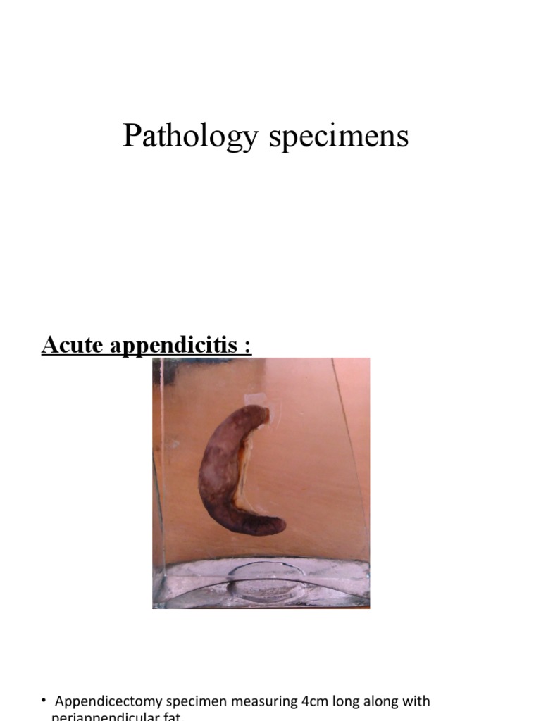 Acute Appendicitis Pathology Specimens | PDF | Gastrointestinal Tract ...