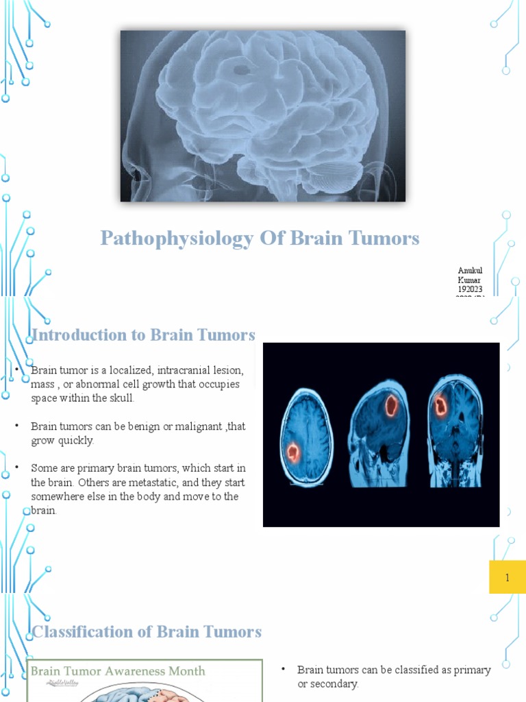 Pathophysiology of Brain Tumors | PDF | Brain Tumor | Metastasis