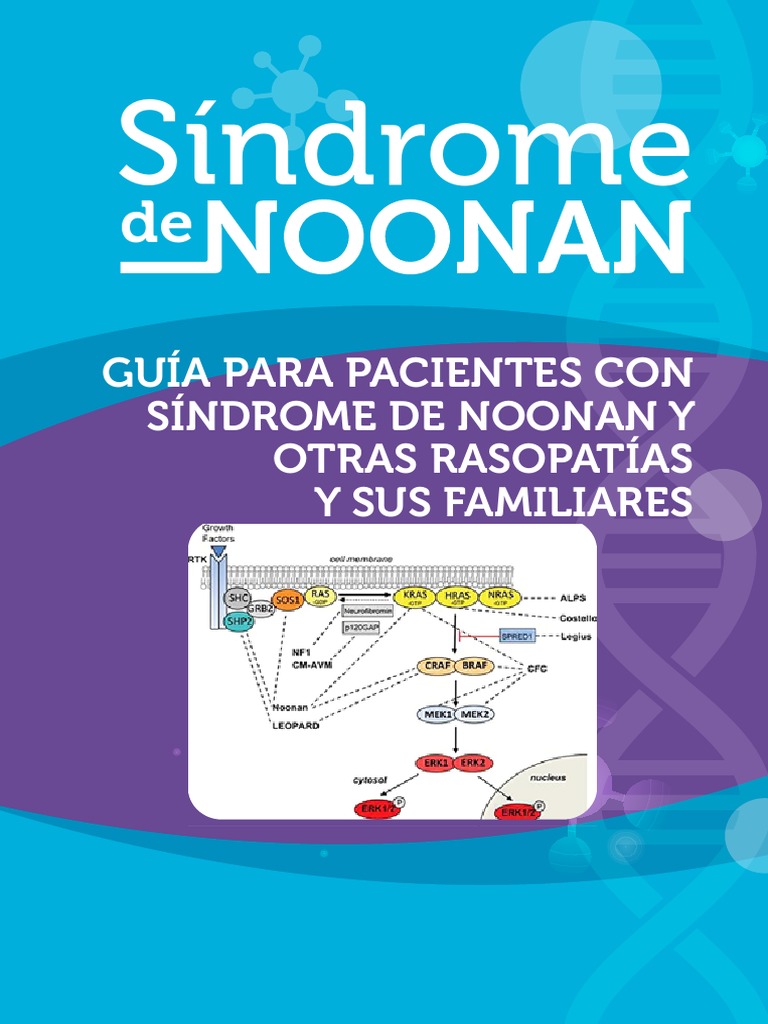Sindrome de Noonan GUIA S N RASOPATIAS | Descargar gratis PDF | Corazón | Gene