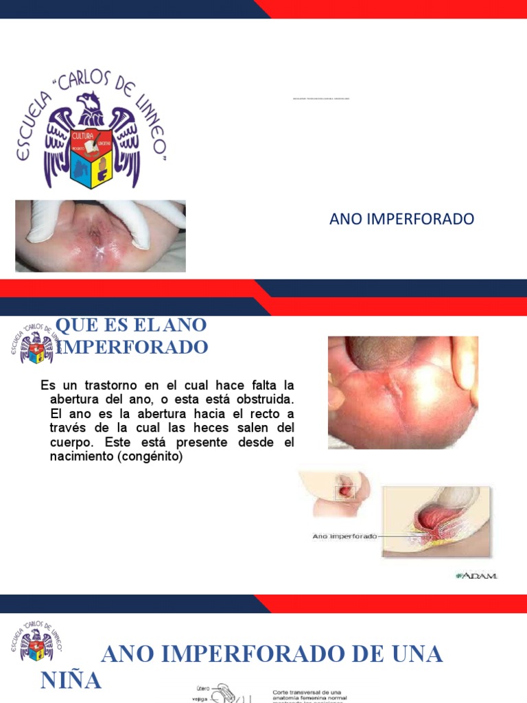 Ano Imperforado | PDF | Salud y bienestar | Estilo de vida