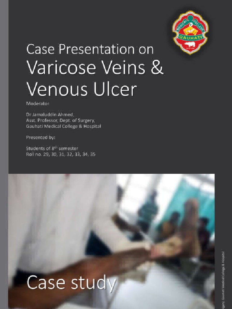 Varicose Veins Case Presentation | PDF