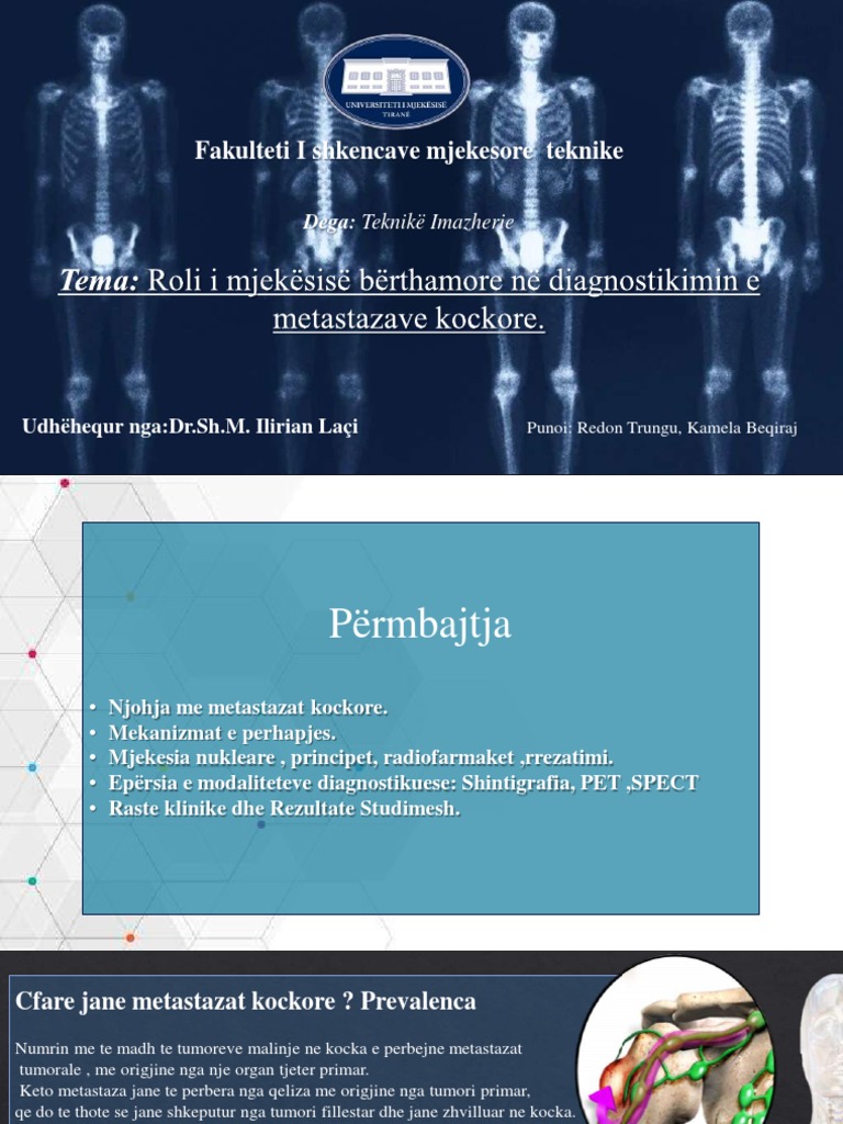 Mjekesia Nukleare Metastazat (Autosaved) | PDF