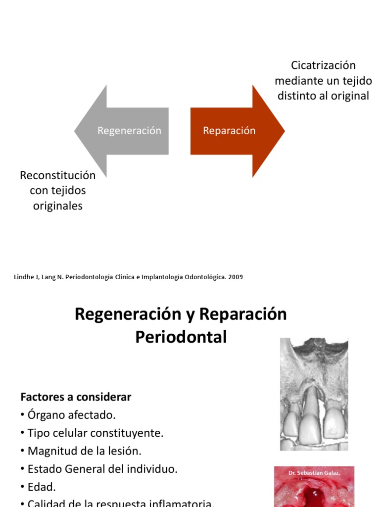 13 - Regeneracion y Reparacion 2023 - Removed | PDF | Cicatrización de ... 13 - Regeneracion y Reparacion 2023 - Removed | PDF | Cicatrización de ...