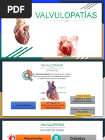 Índices Sokolow y Lewis en EKG | PDF