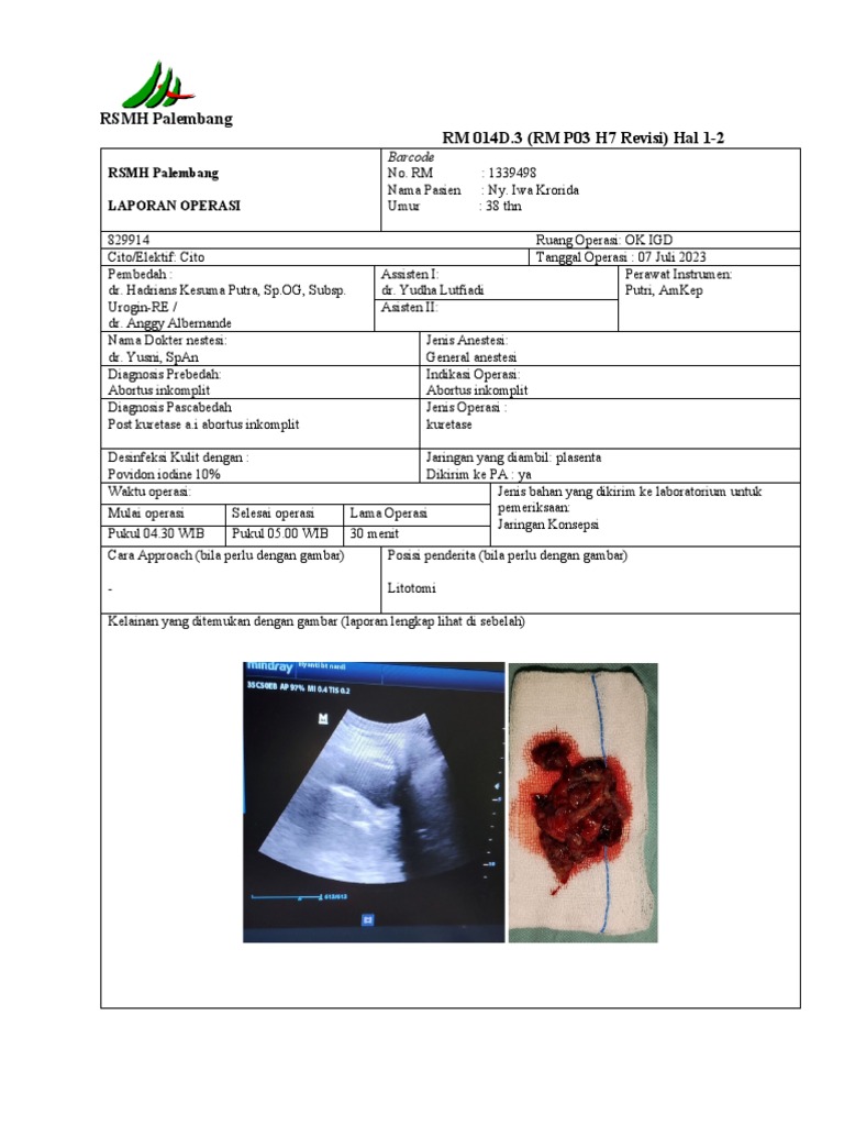 Laporan Operasi Kuretase IWA K - HD | PDF